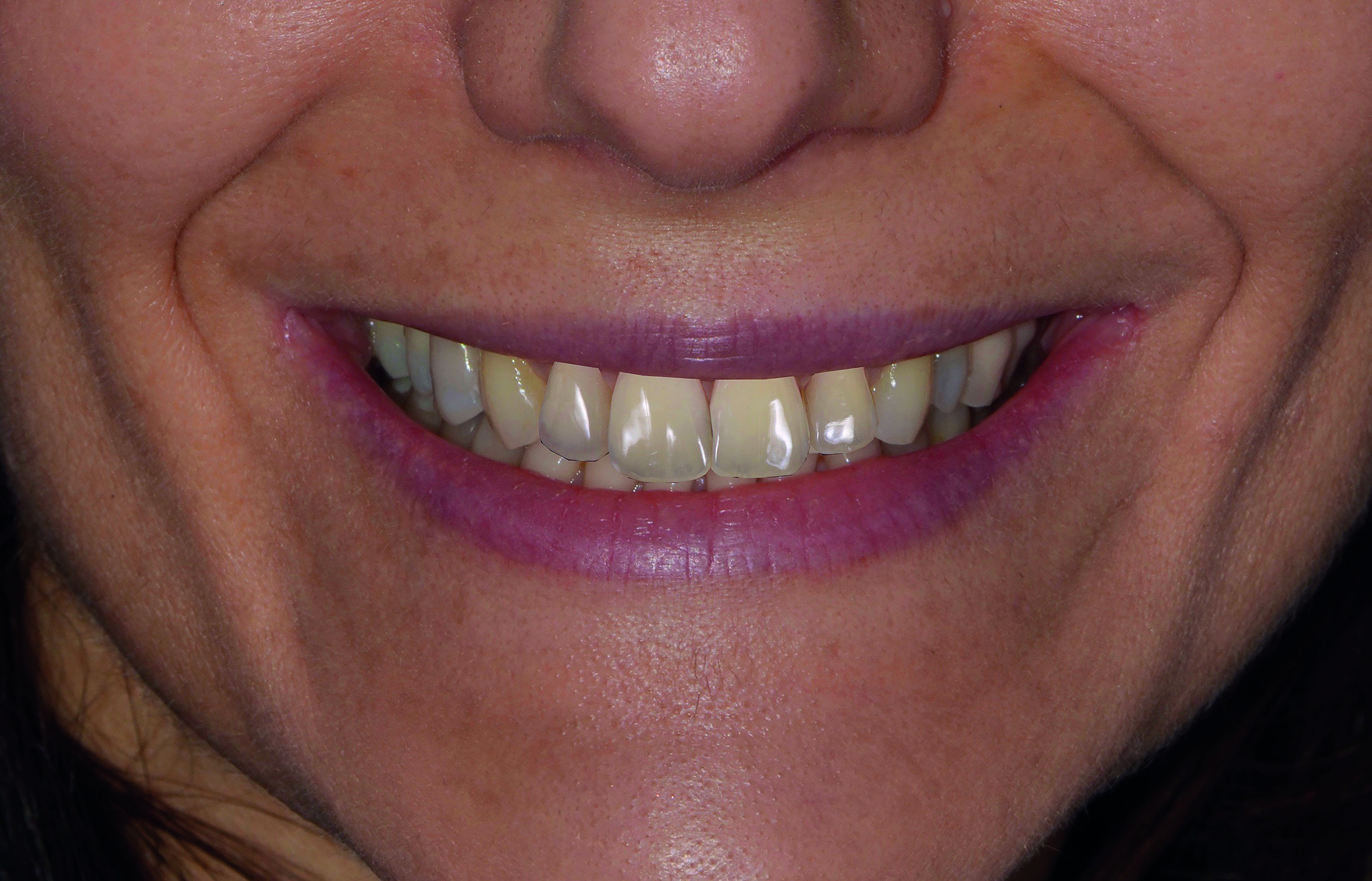 Dental News - Aesthetic Digital Smile Design: 2-D-/3-D-assisted ...