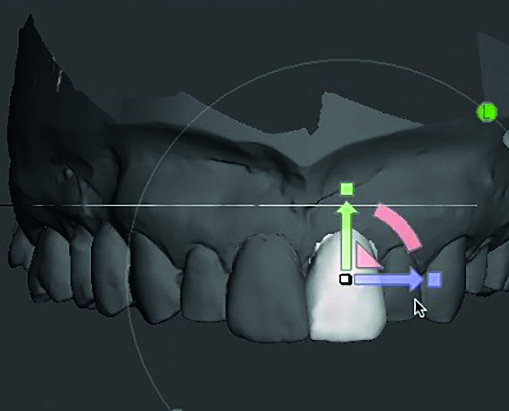 Dental News - Aesthetic Digital Smile Design: 2-D-/3-D-assisted ...