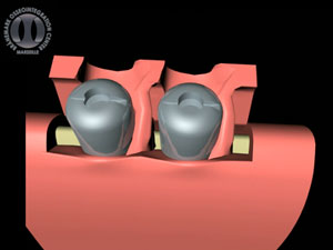 "I was 20 years ahead"- Dr. Patrick Palacci in conversation with three ...